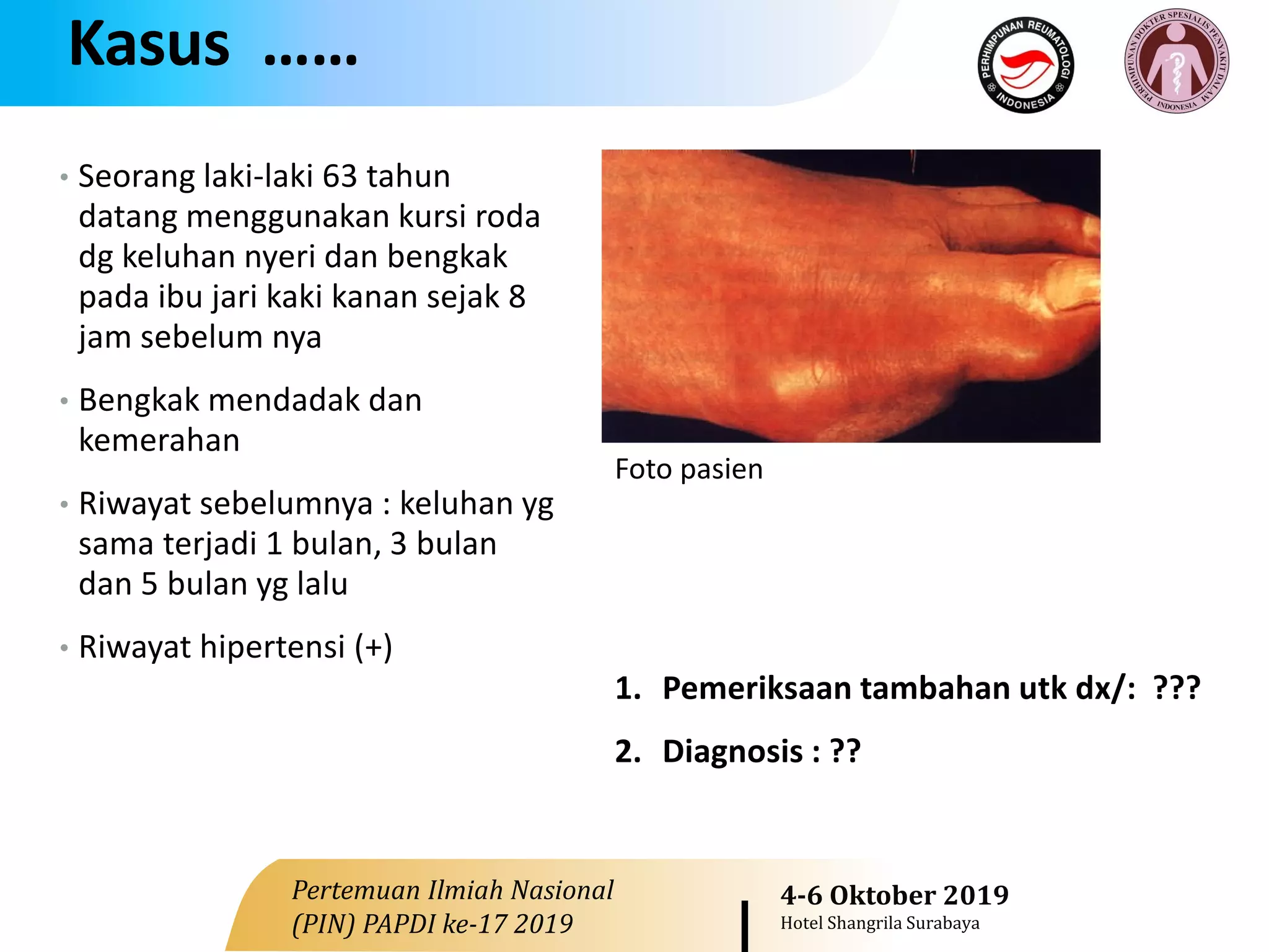 dr Gede Kambayana - Penatalaksanaan Gout (PIN PAPDI)edit.pdf dr Gede Kambayana - Penatalaksanaan Gout (PIN PAPDI)edit.pdf