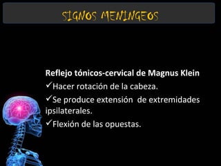 Sindrome Meningeo | PPT