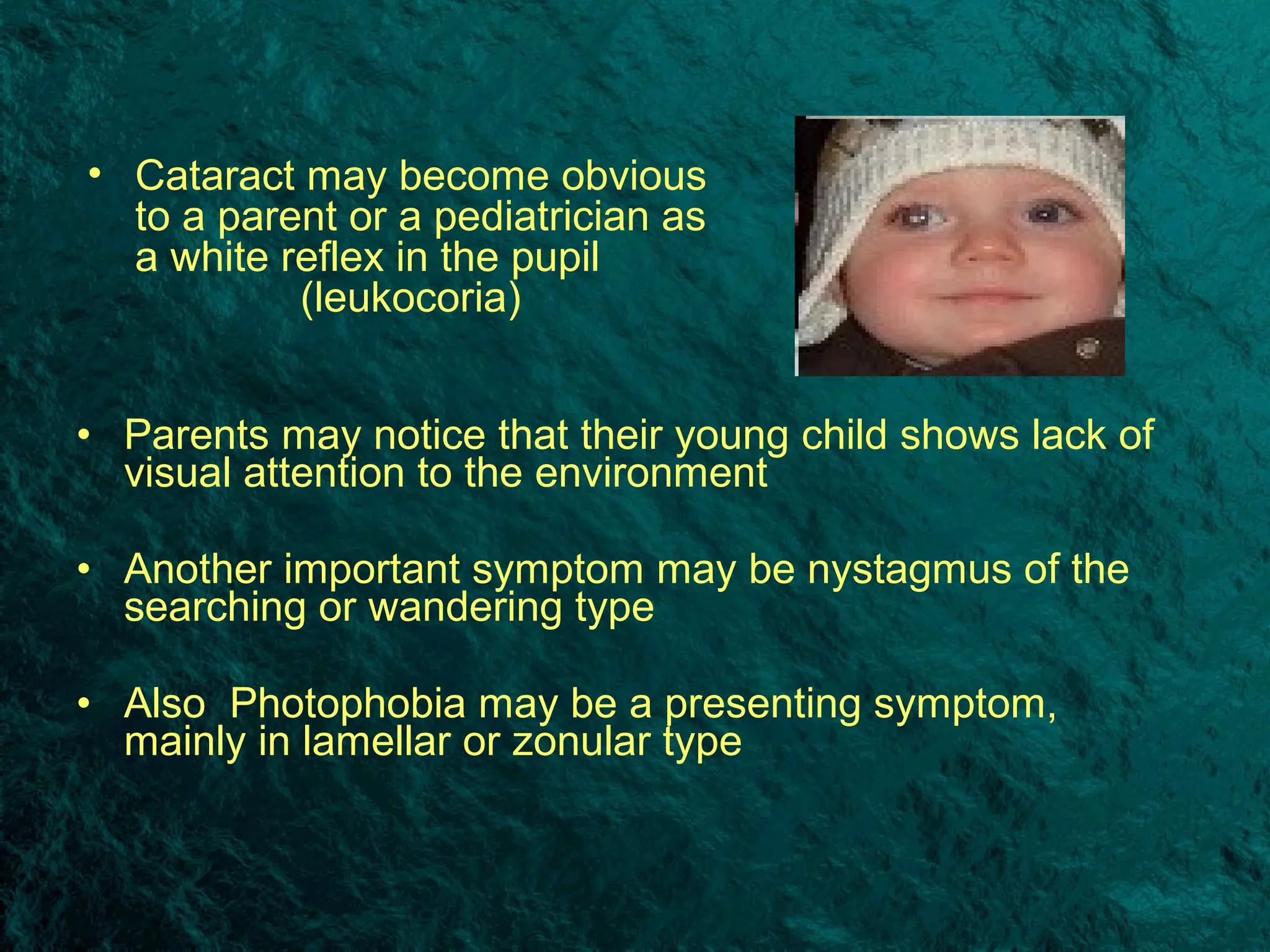 Congenital cataract | PPT