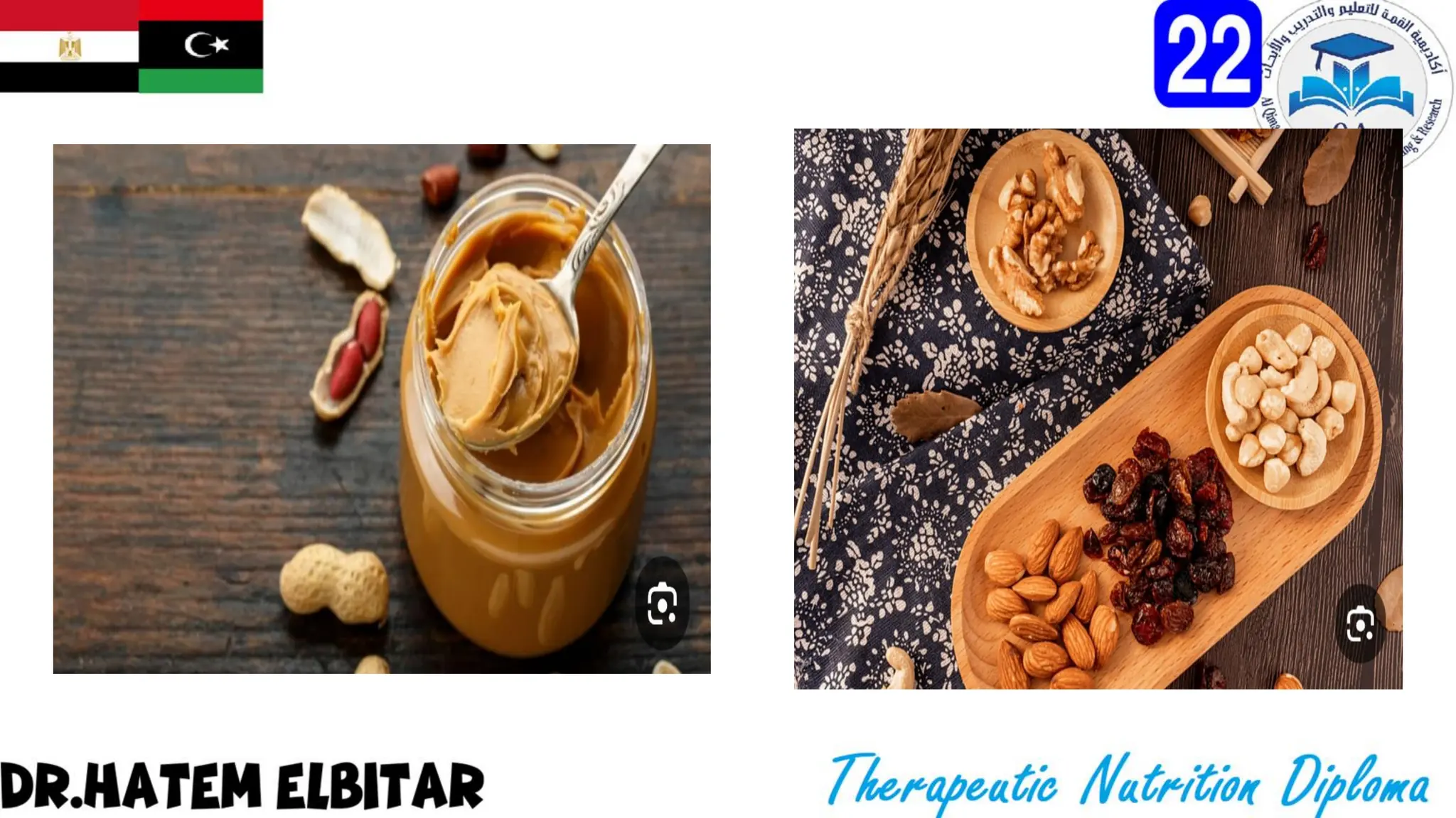 dr hatem elbitar (1).pdf