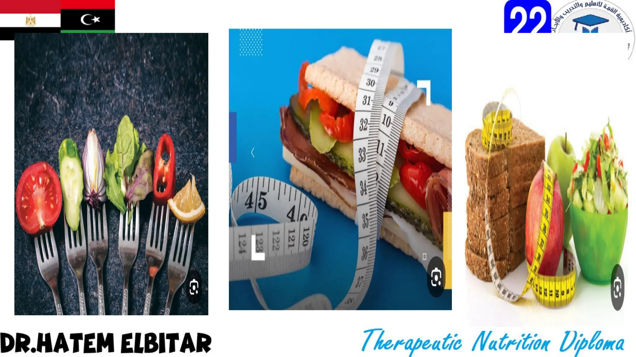 dr hatem elbitar (1).pdf