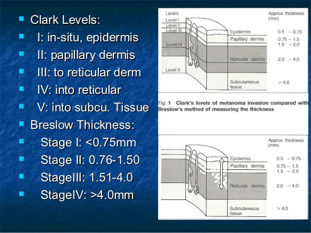 Head and Neck Melanoma