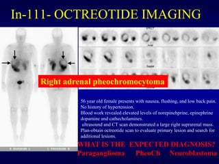 Octreotide Scan