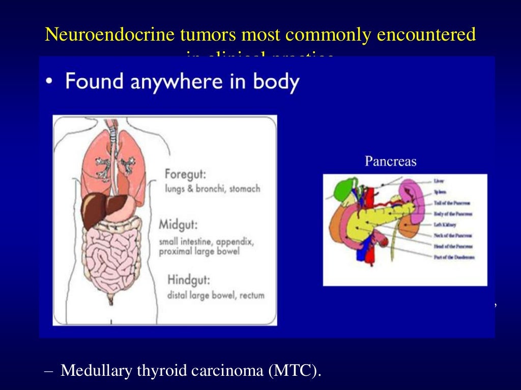 Radionuclide neuroendocrine tumors functional imaging