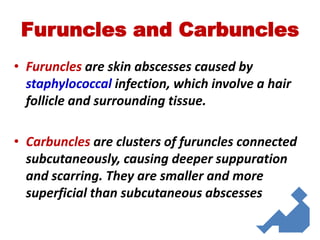 Dr hussein, bacterial infec of the skin | PPT