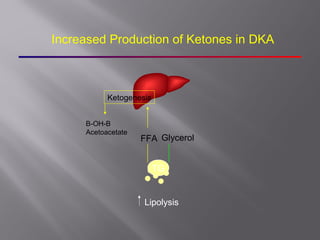 diabetic ketoacidosis | PPT