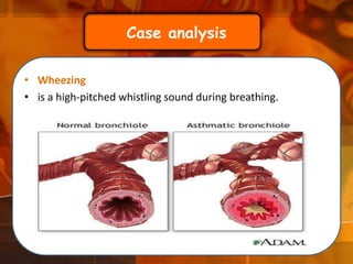 Drinking alcohol + respiratory system | PPTX
