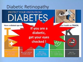 Common Eye Diseases | PPTX