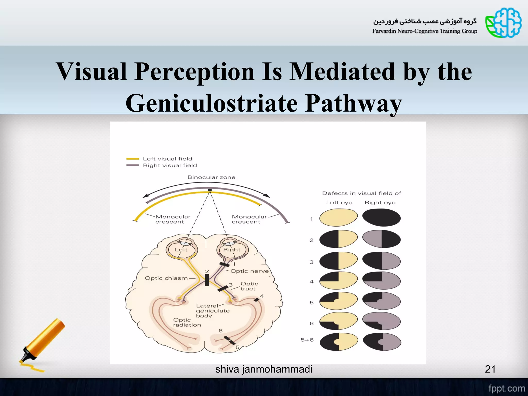 visual motor perception in Cerebral Palsy | PPT