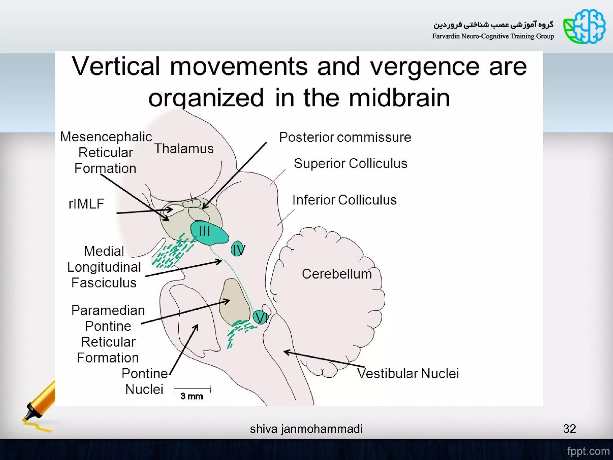 visual motor perception in Cerebral Palsy | PPT