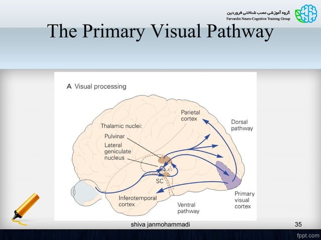 visual motor perception in Cerebral Palsy | PPT