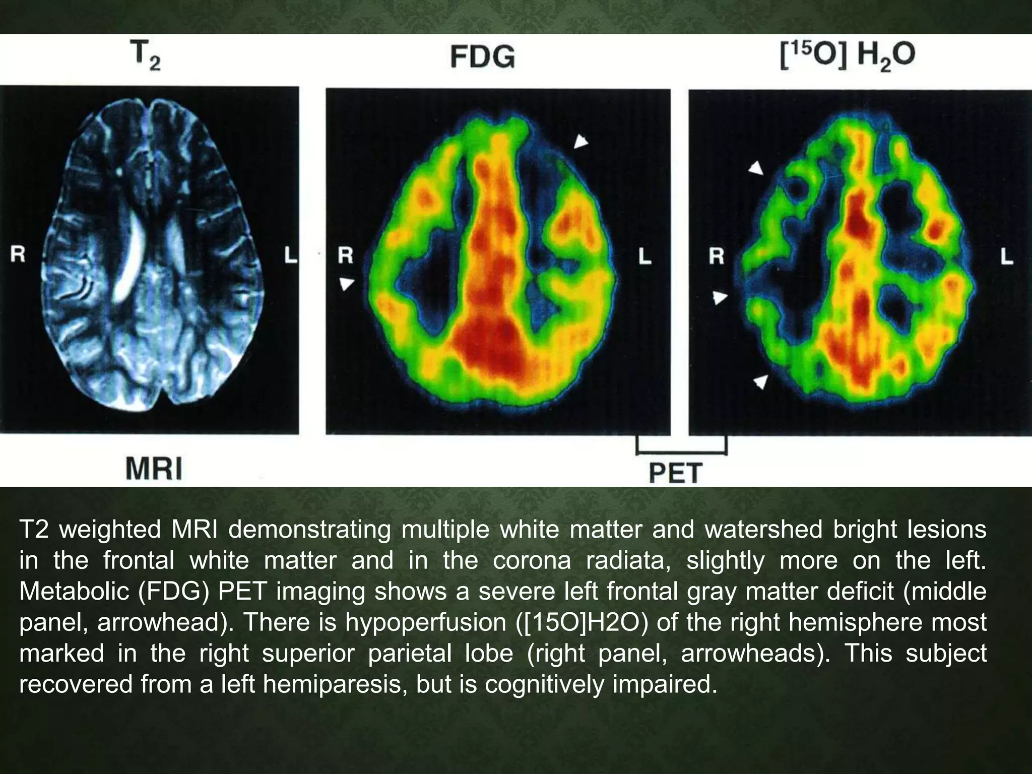 Measurement of Cerebral Blood Flow | PPTX | Medical Tests | Medical Health