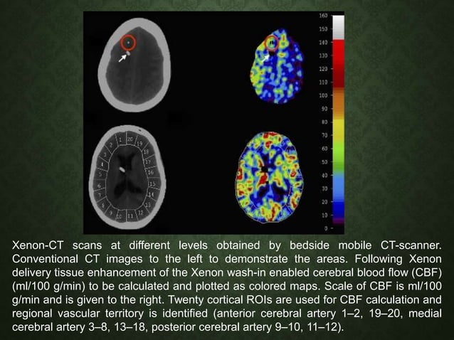 Measurement of Cerebral Blood Flow | PPTX | Medical Tests | Medical Health