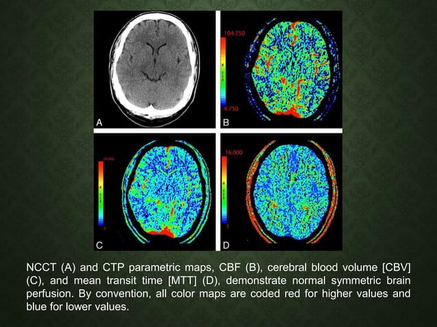 Measurement of Cerebral Blood Flow | PPTX | Medical Tests | Medical Health