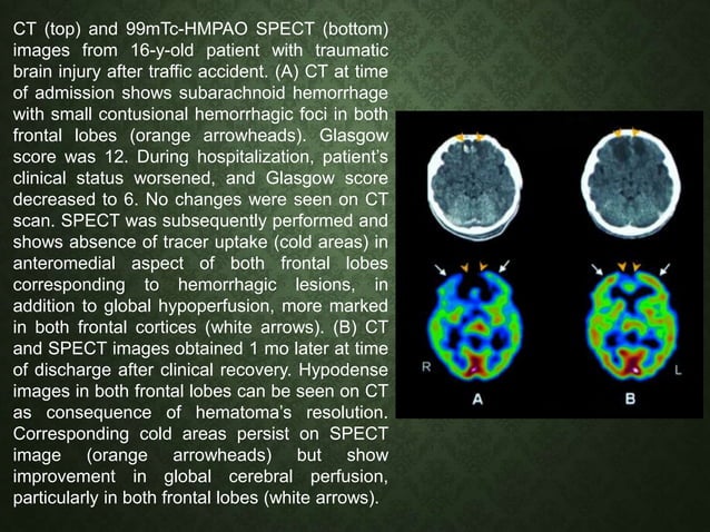 Measurement of Cerebral Blood Flow | PPTX | Medical Tests | Medical Health