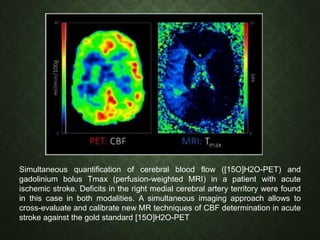 Measurement of Cerebral Blood Flow | PPTX