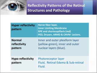 Optical/ocular coherence tomography OCT All in one Presentation | PPTX