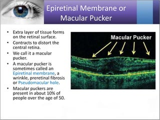 Optical/ocular coherence tomography OCT All in one Presentation | PPTX
