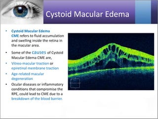 Optical/ocular coherence tomography OCT All in one Presentation | PPTX