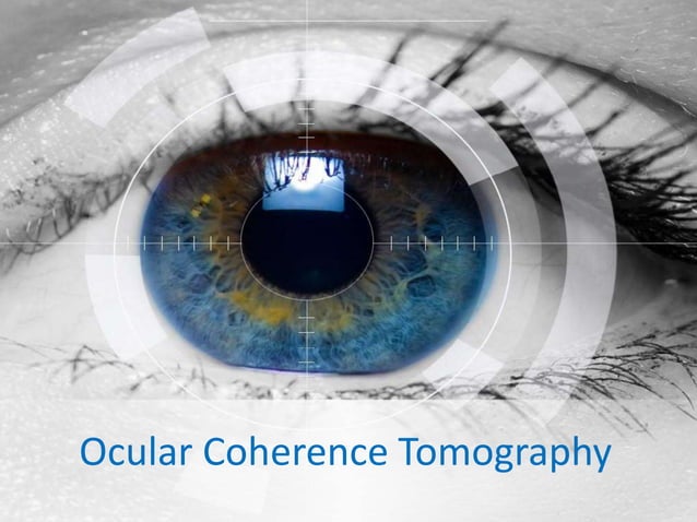 Optical/ocular coherence tomography OCT All in one Presentation | PPTX ...