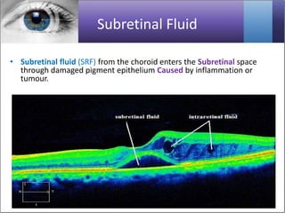 Optical/ocular coherence tomography OCT All in one Presentation | PPTX