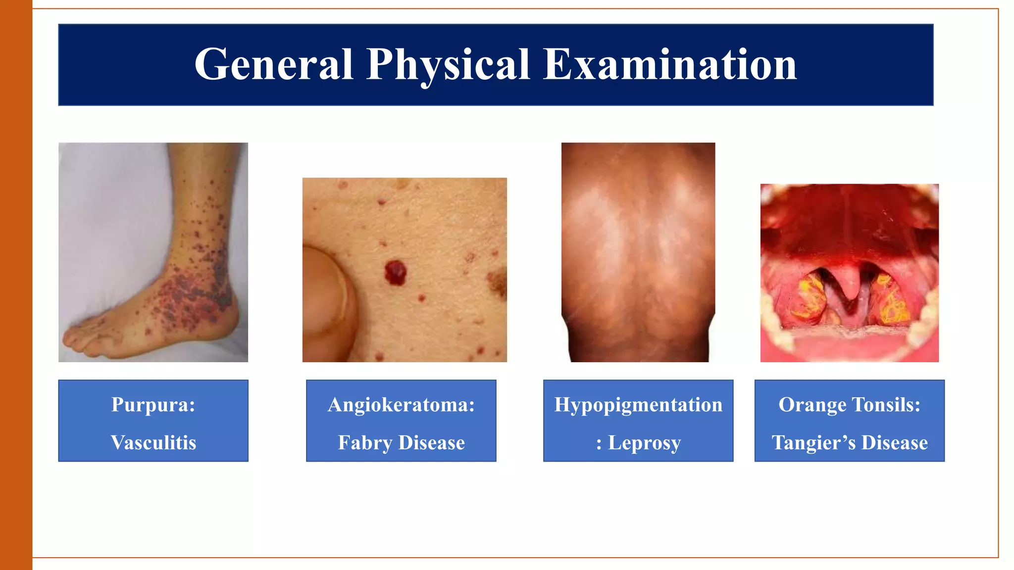 Approach to Peripheral Neuropathy | PPTX