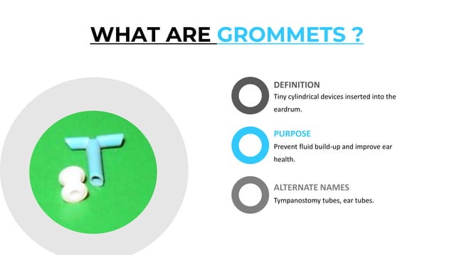 Understanding Grommets by Dr Brett Leavers - ENT Surgeon | PDF