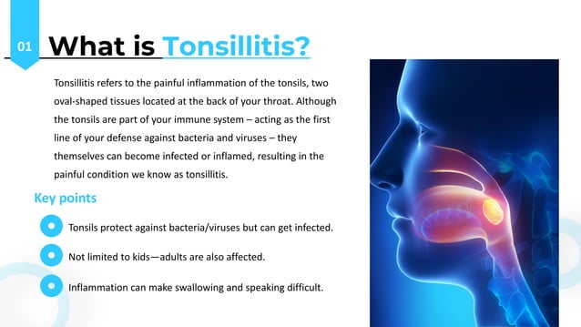 Understanding Tonsillitis by Dr. Brett Leavers | PPT