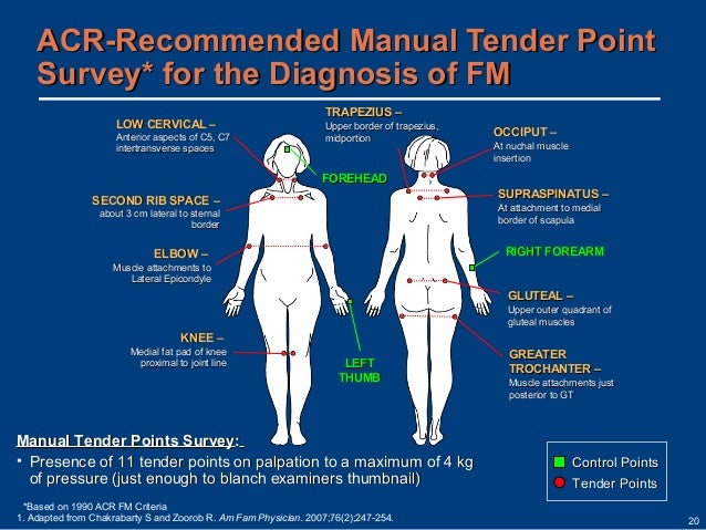 Dr liu fibromyalgia disease overview-1