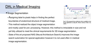 DRL Medical Imaging Literature Review | PPT