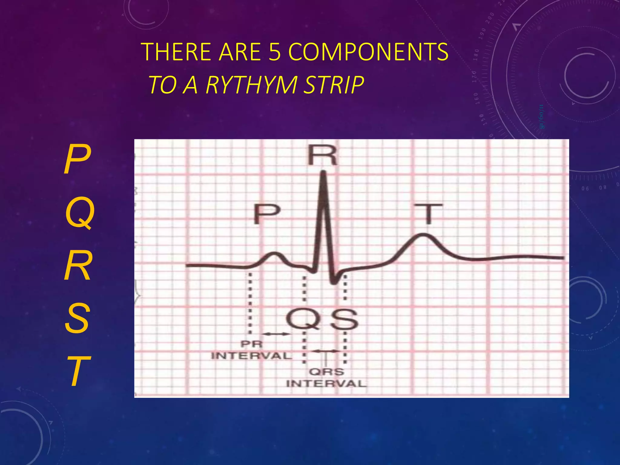 ACLS EKG quiz | PPT