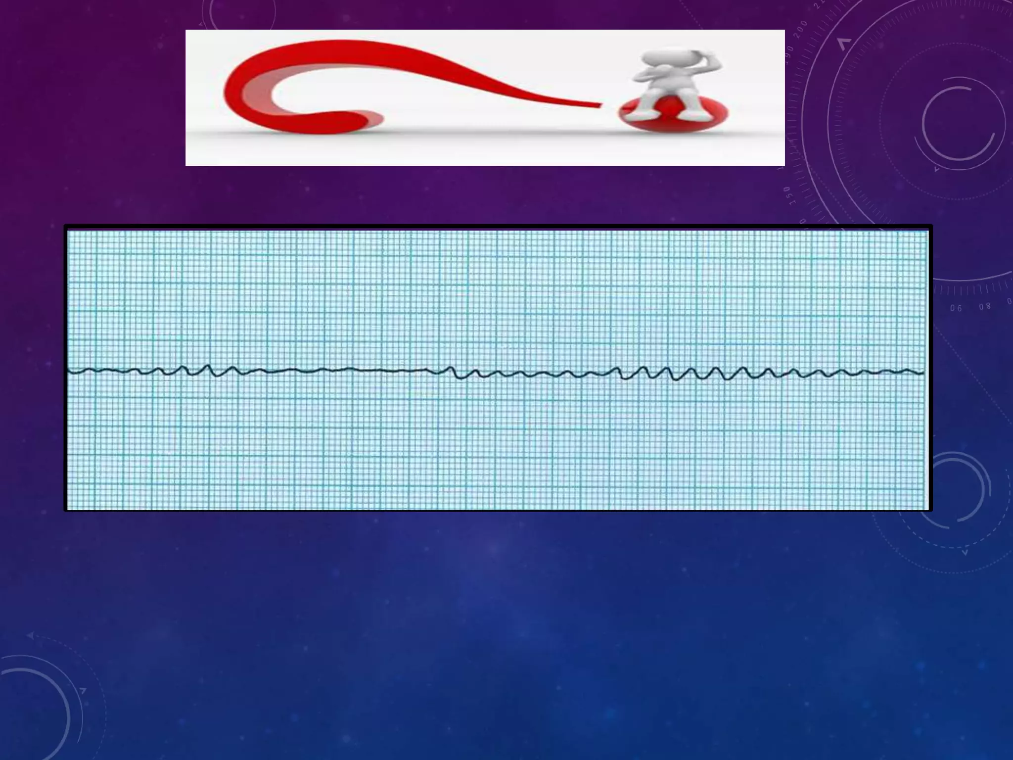 ACLS EKG quiz | PPT
