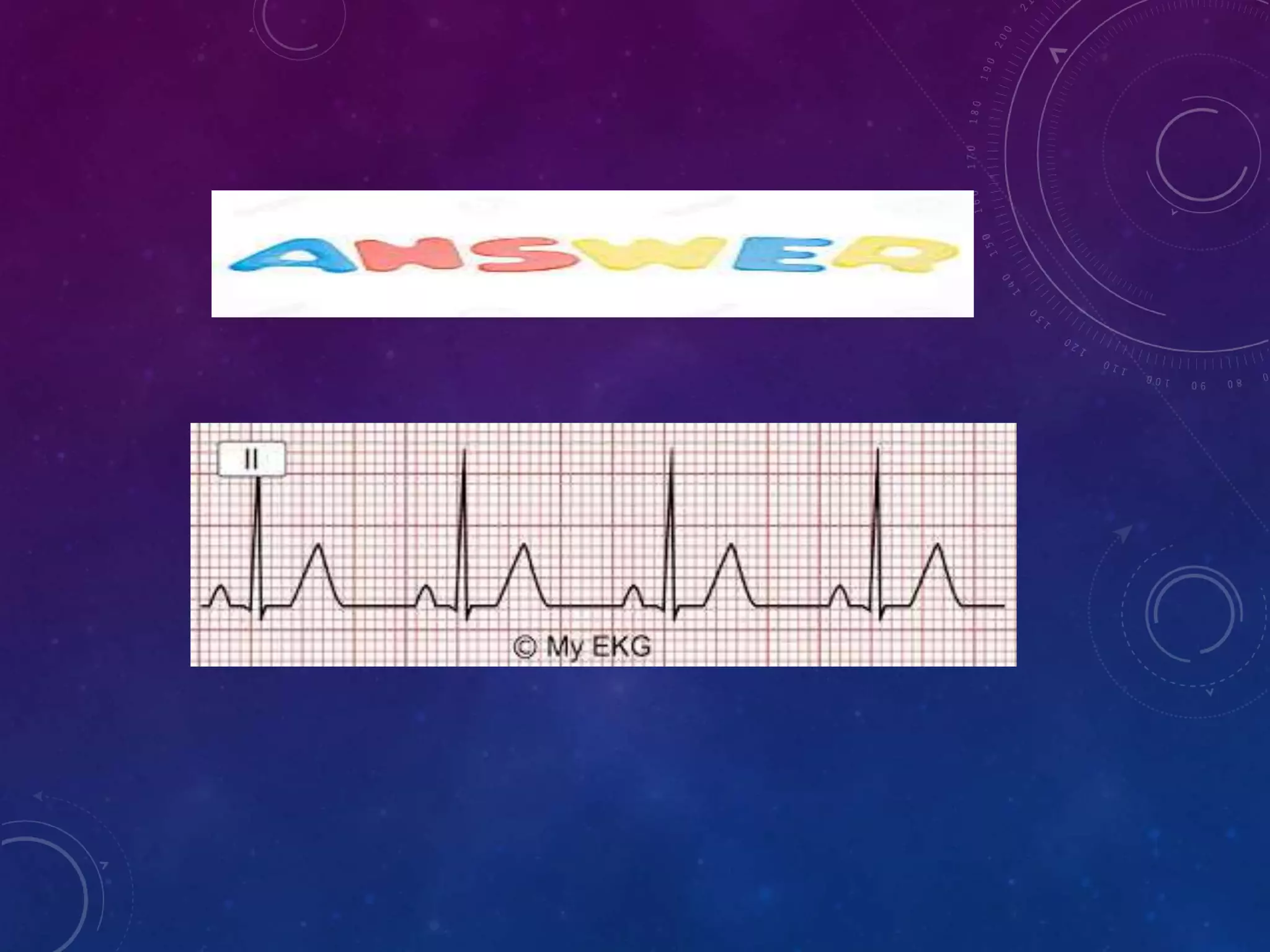 ACLS EKG quiz | PPT
