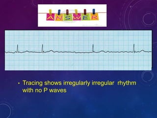 ACLS EKG quiz | PPT