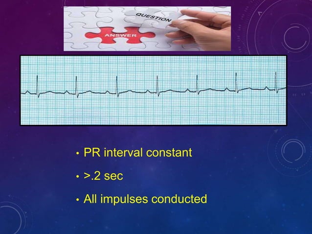 ACLS EKG quiz | PPT
