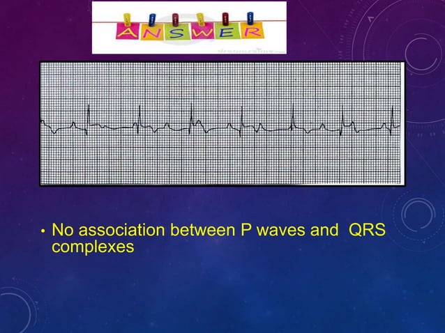 ACLS EKG quiz | PPT