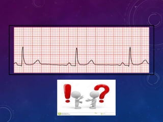 ACLS EKG quiz | PPT