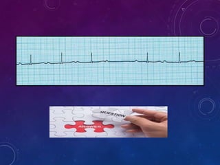 ACLS EKG quiz | PPT