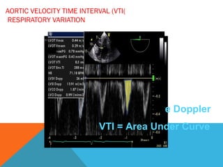 Dr masjedi hemodynamic monitoring in ICU | PPT