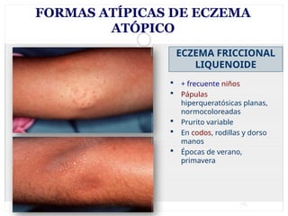 resuemen de dermatitis atopica y sus caracteristicas | PPTX