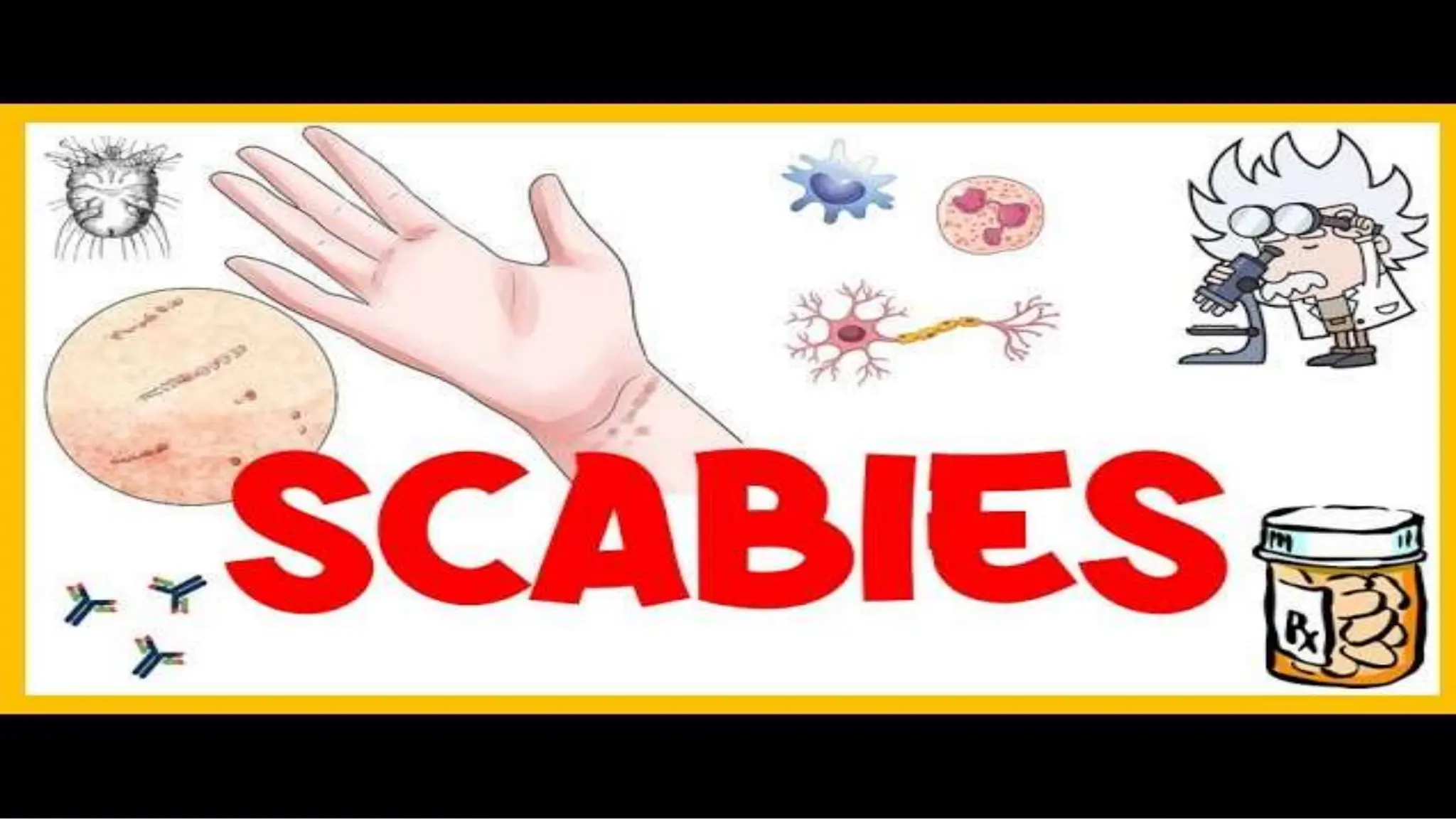 drmatology Ppt (Scabies,Eczema,Psoriasis,) | PPTX
