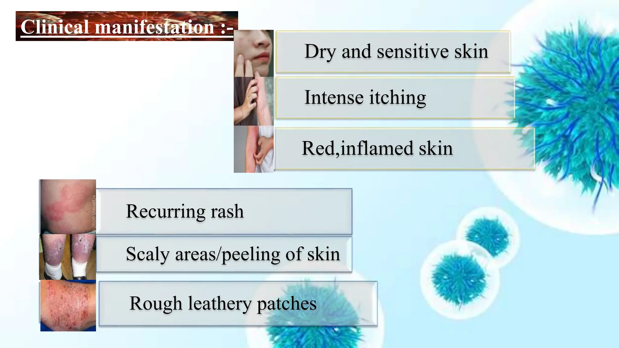 drmatology Ppt (Scabies,Eczema,Psoriasis,) | PPTX