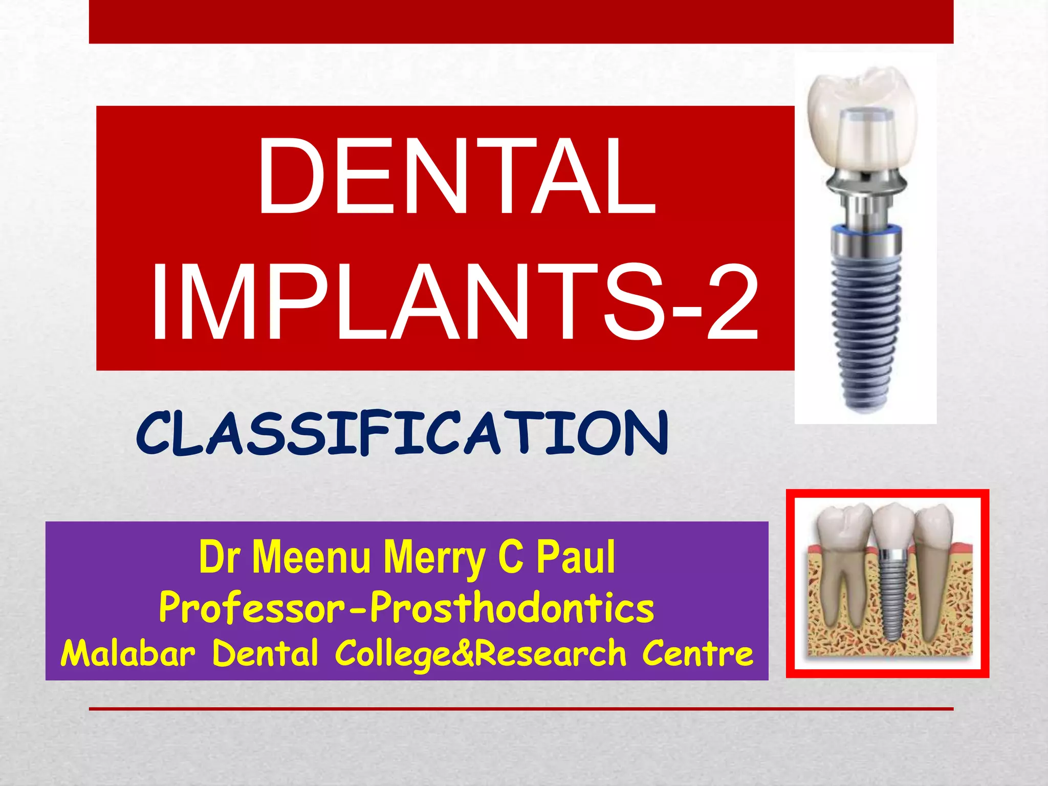 DENTAL IMPLANTS-2 CLASSIFICATION- Dr MEENU MERRY C PAUL | PPT