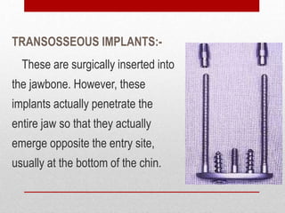 DENTAL IMPLANTS-2 CLASSIFICATION- Dr MEENU MERRY C PAUL | PPT