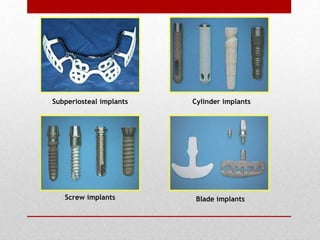 DENTAL IMPLANTS-2 CLASSIFICATION- Dr MEENU MERRY C PAUL | PPT