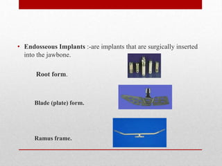 DENTAL IMPLANTS-2 CLASSIFICATION- Dr MEENU MERRY C PAUL | PPT