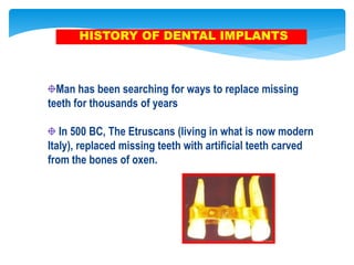 DENTAL IMPLANTS-1 HISTORY- Dr MEENU MERRY C PAUL | PPT