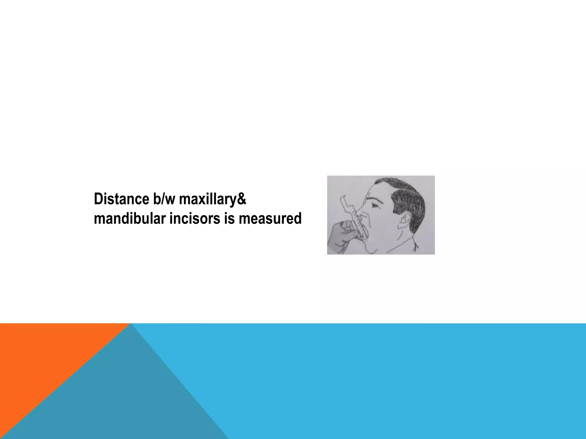 INTRODUCTION TO FIXED PARTIAL DENTURES-Dr MEENU MERRY C PAUL | PPTX