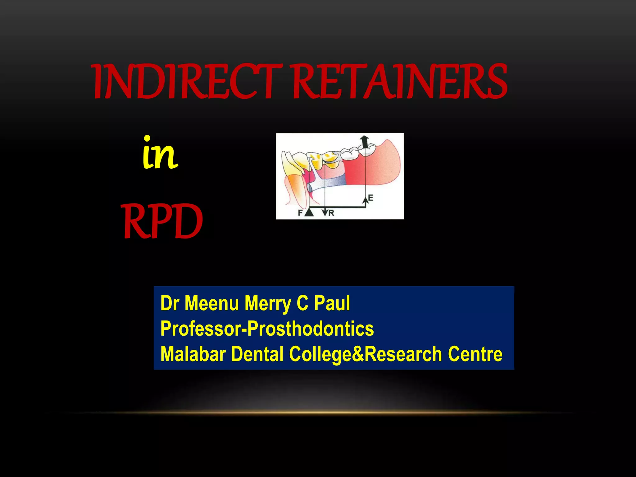 INDIRECT RETAINERS IN CAST PARTIAL DENTURES- Dr MEENU MERRY C PAUL | PPTX