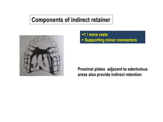 INDIRECT RETAINERS IN CAST PARTIAL DENTURES- Dr MEENU MERRY C PAUL | PPT